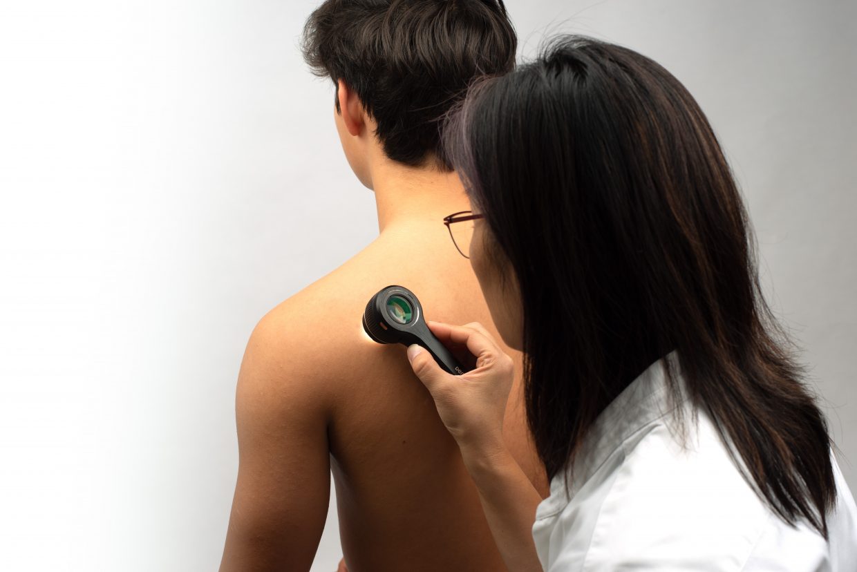 Use of the Dermatoscope - MoleMax Systems