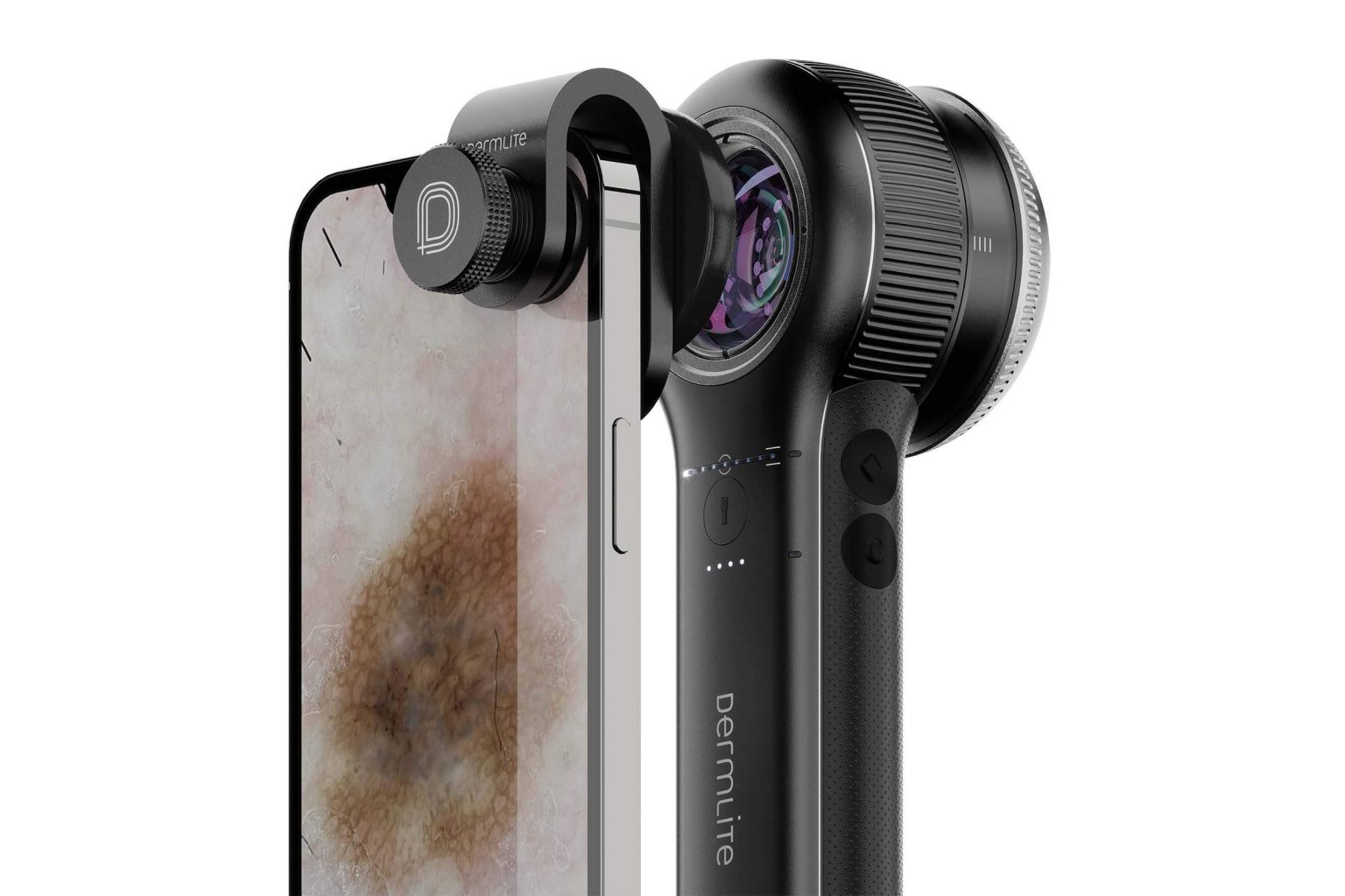 DermLite DL5 Hand Held Dermatoscope - MoleMax Systems